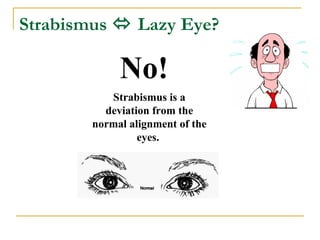 Strabismus | PPT | Eye and Vision Conditions | Diseases and Conditions