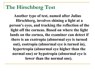 Strabismus | PPT | Eye and Vision Conditions | Diseases and Conditions