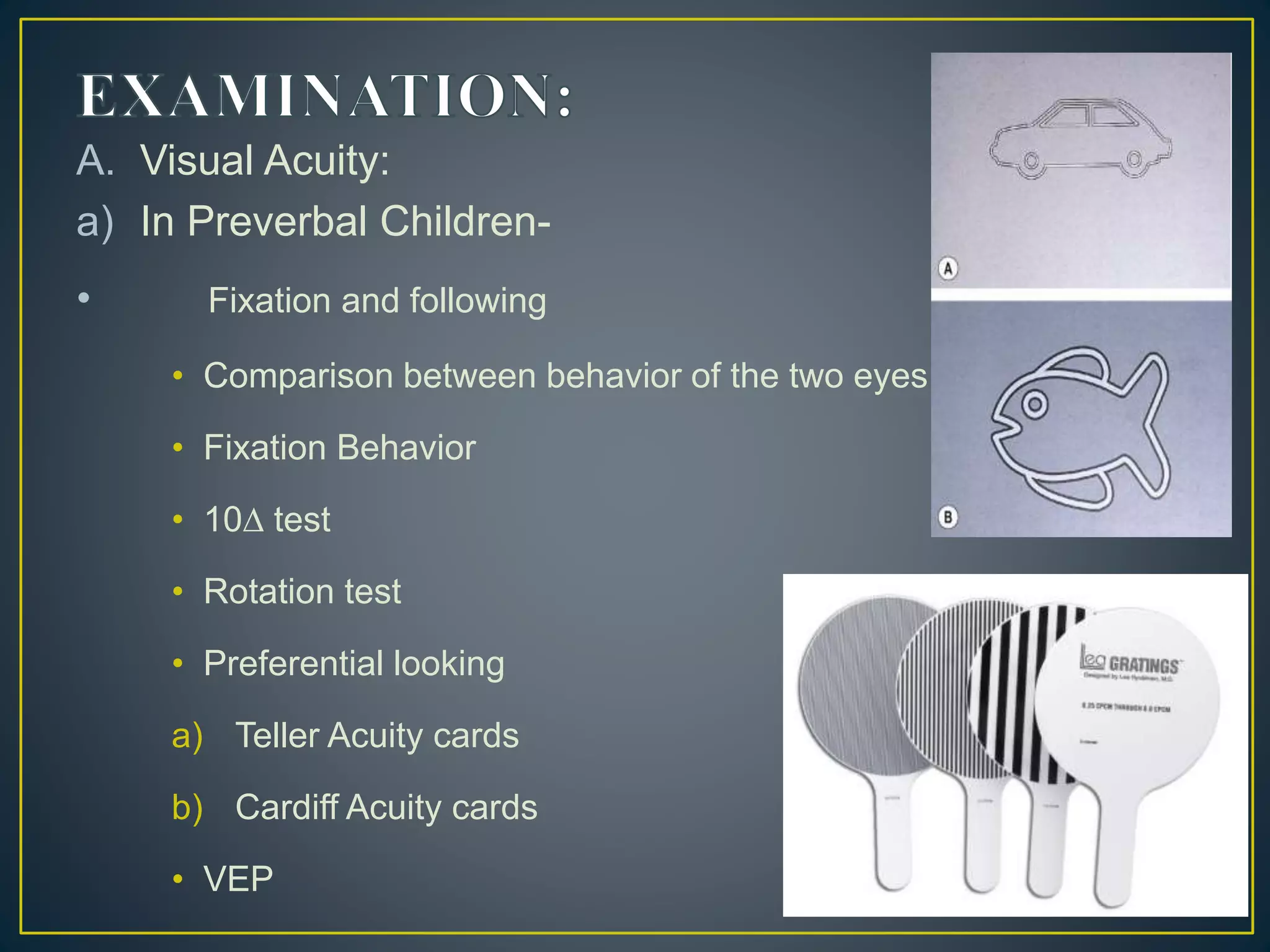 Strabismus-Clinical Examinations | PPTX