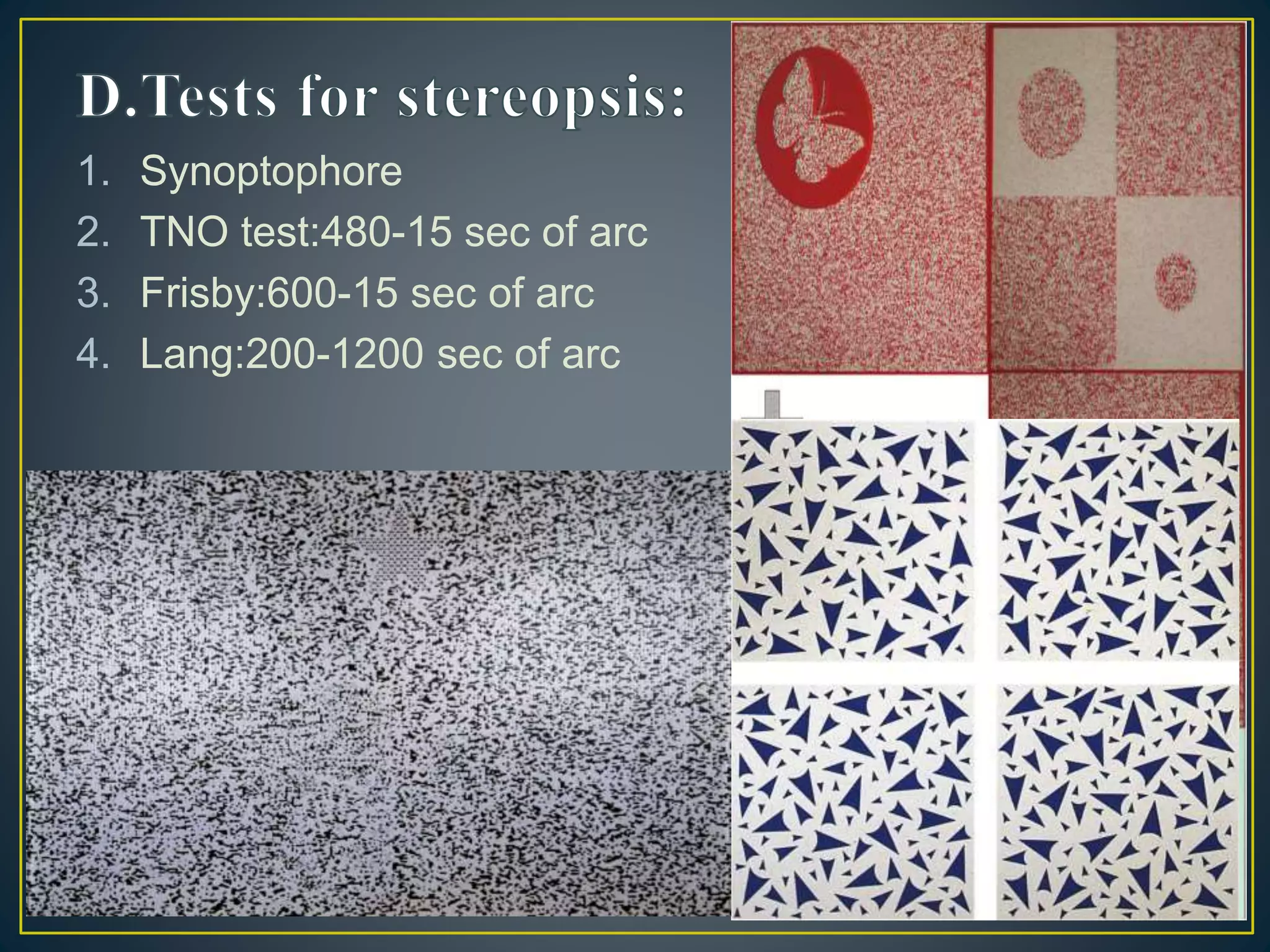 Strabismus-Clinical Examinations | PPTX