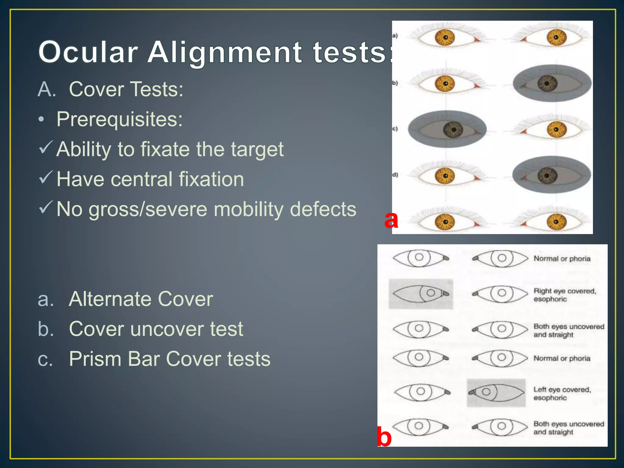 Strabismus-Clinical Examinations | PPTX