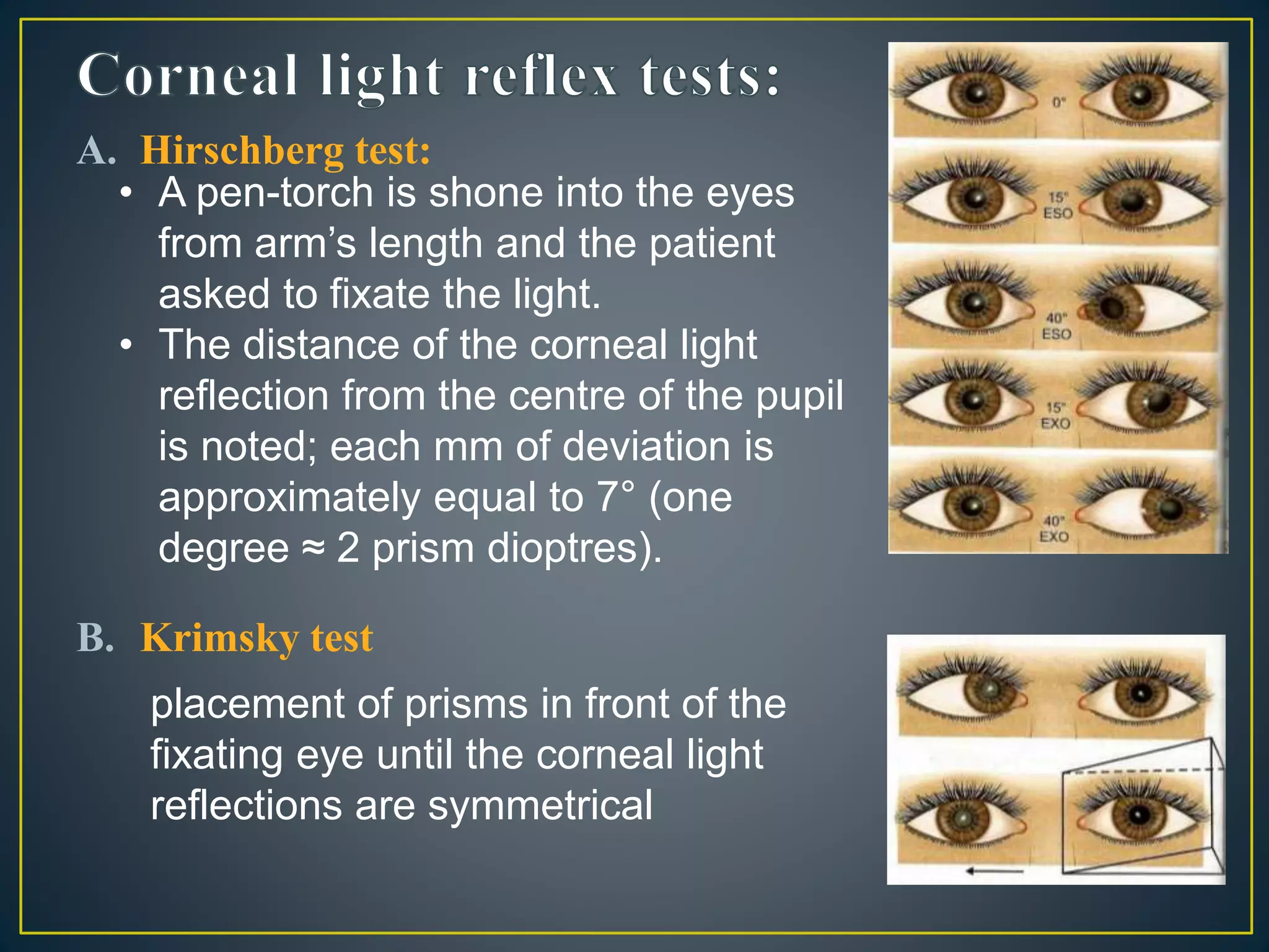 Strabismus-Clinical Examinations | PPTX