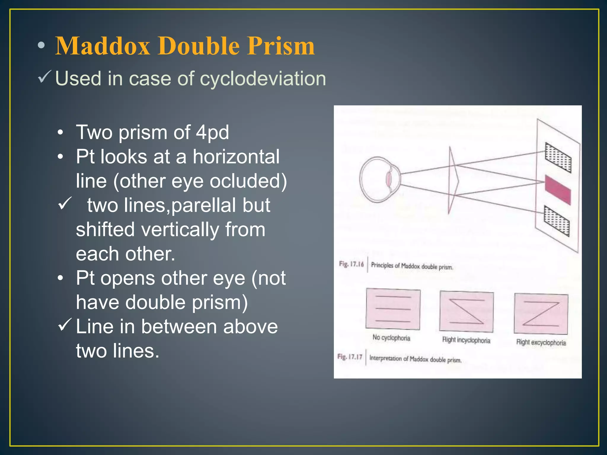Strabismus-Clinical Examinations | PPTX