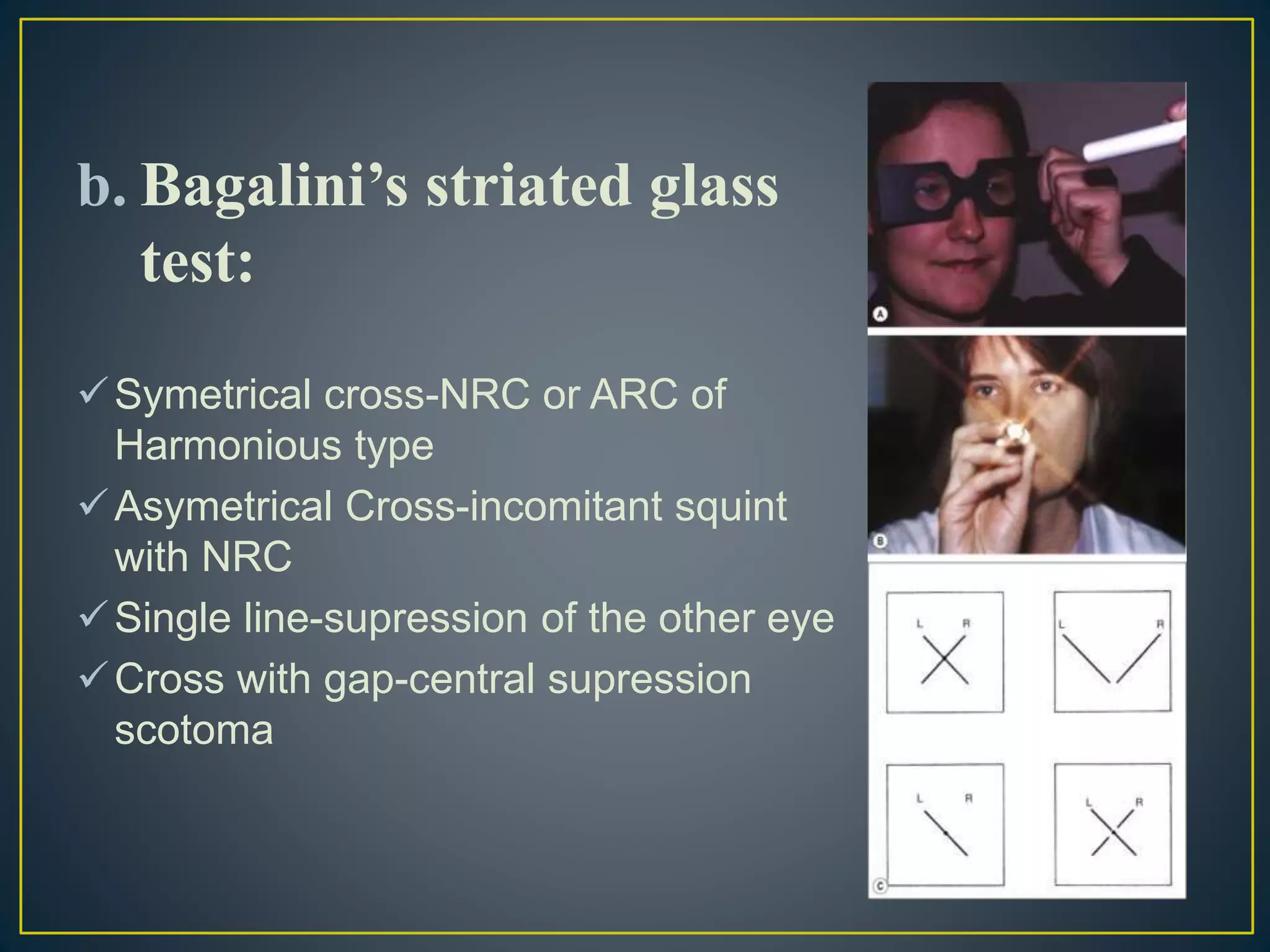 Strabismus-Clinical Examinations | PPTX