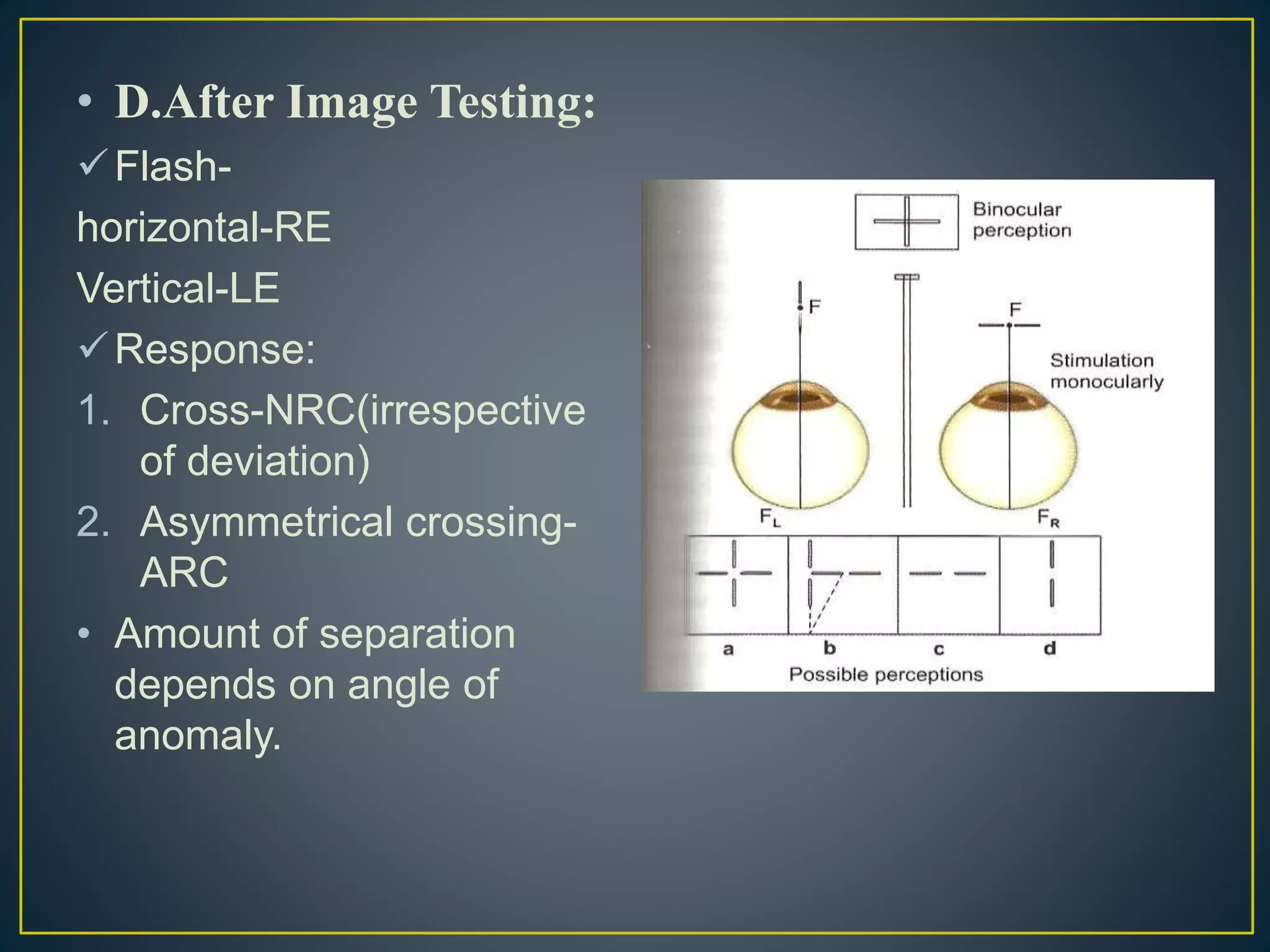Strabismus-Clinical Examinations | PPTX