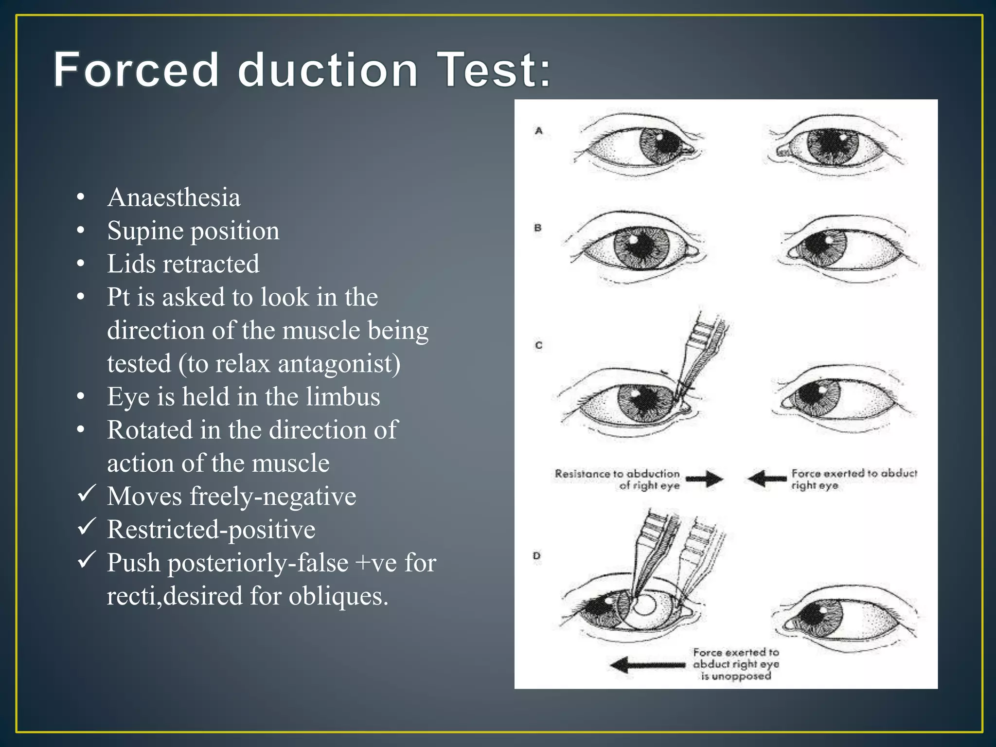 Strabismus-Clinical Examinations | PPTX