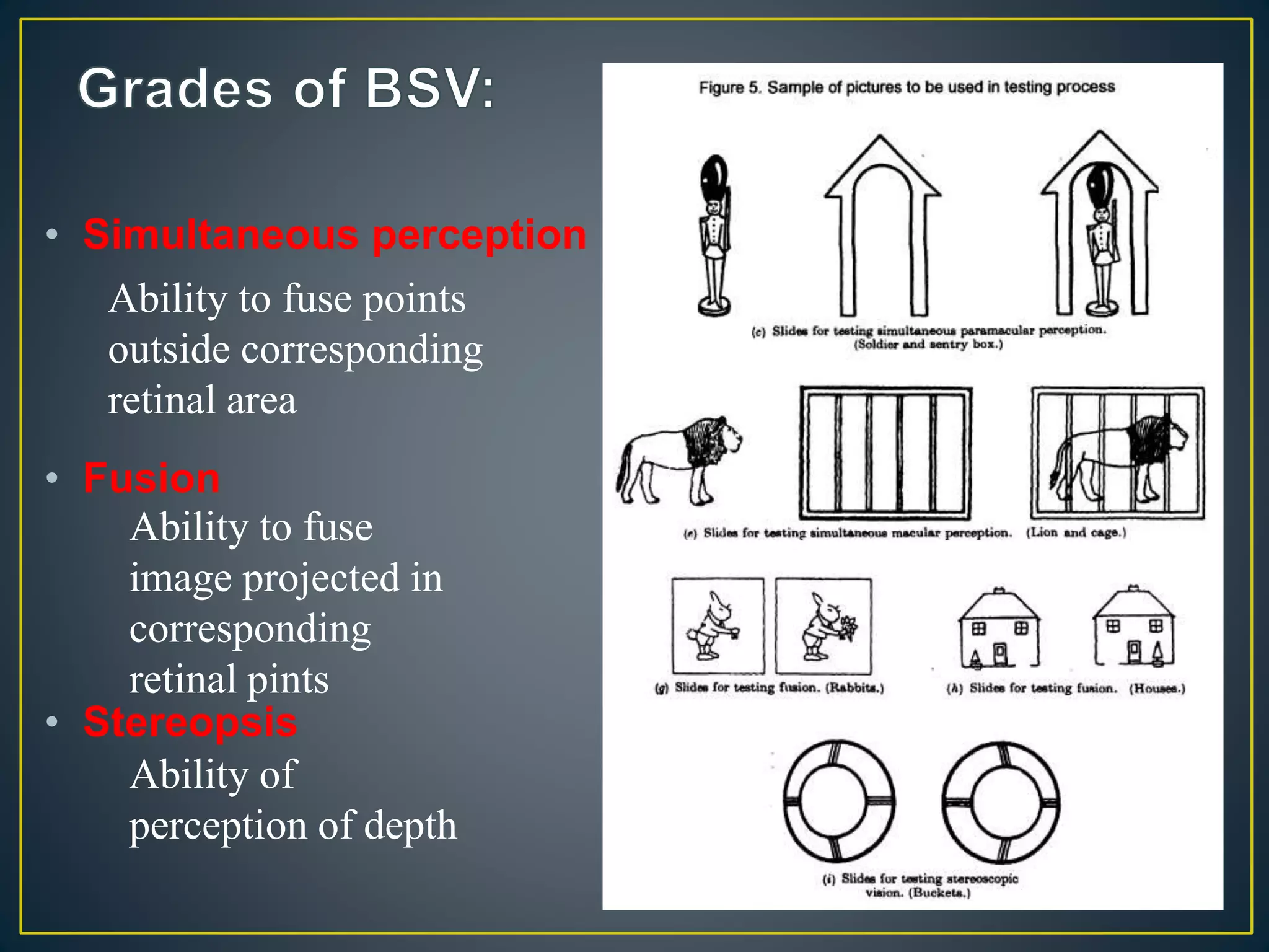 Strabismus-Clinical Examinations | PPTX
