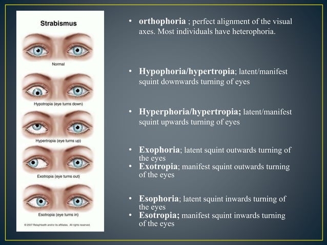 Strabismus-Clinical Examinations | PPTX