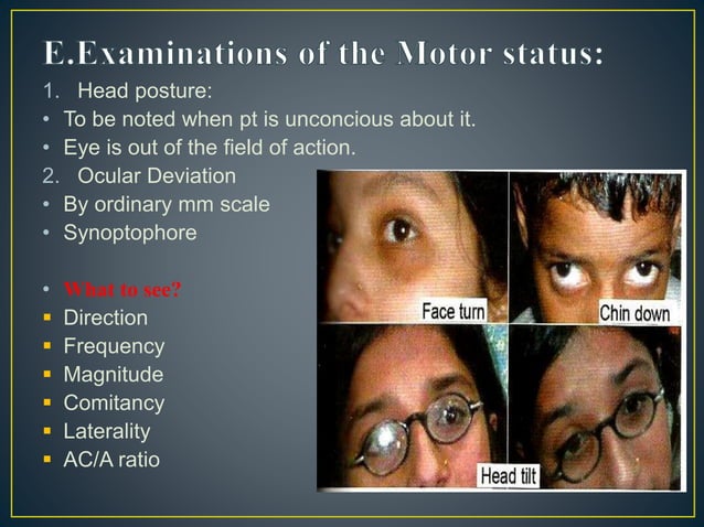 Strabismus-Clinical Examinations | PPTX