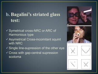 Strabismus-Clinical Examinations | PPTX
