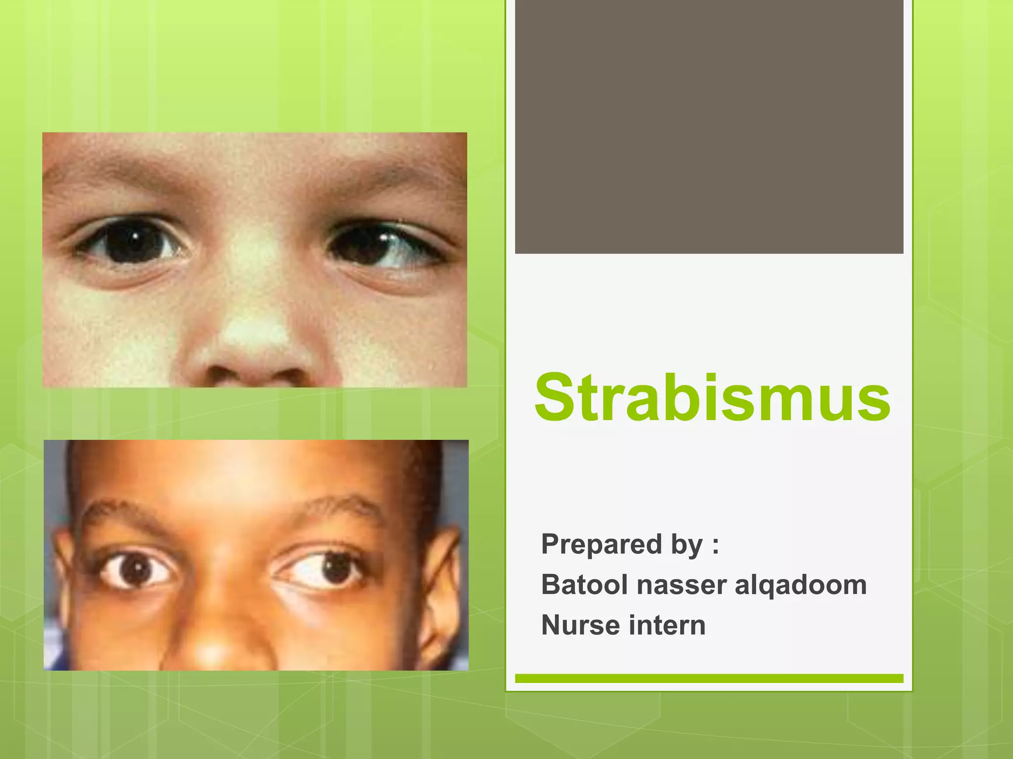 Strabismus | PPTX