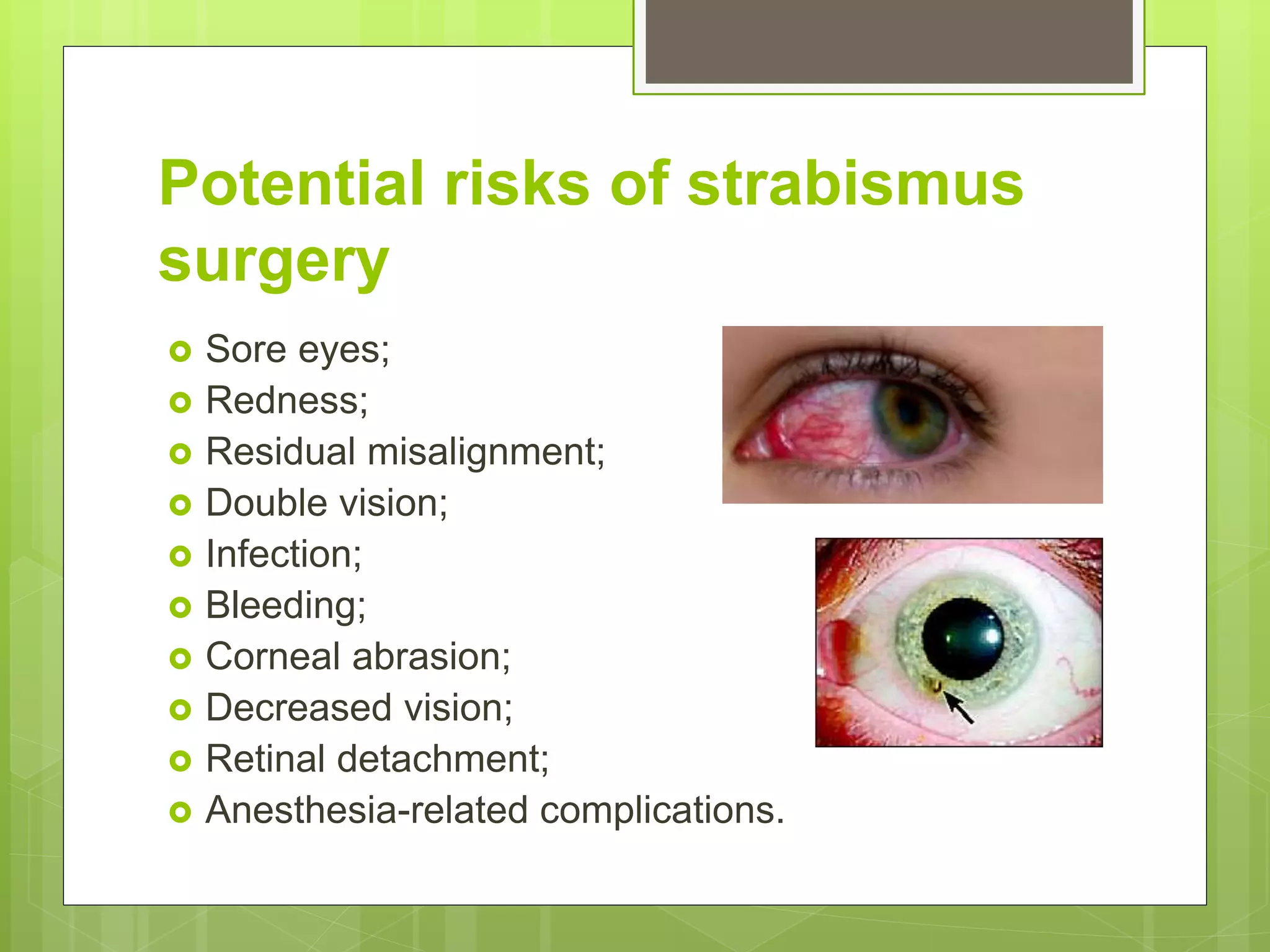 Strabismus | PPTX