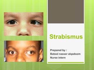 Strabismus | PPTX