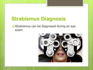 Strabismus | PPTX