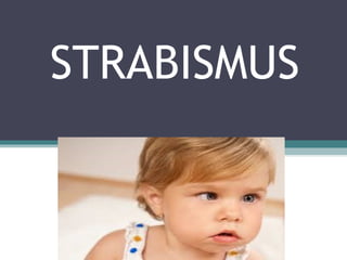 Strabismus | PPT