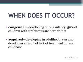 Strabismus | PPT