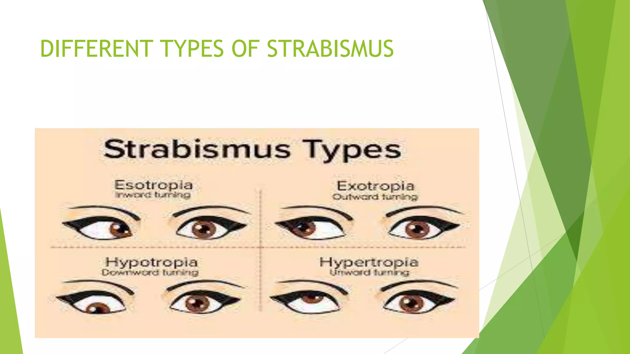 strabismus.pptx