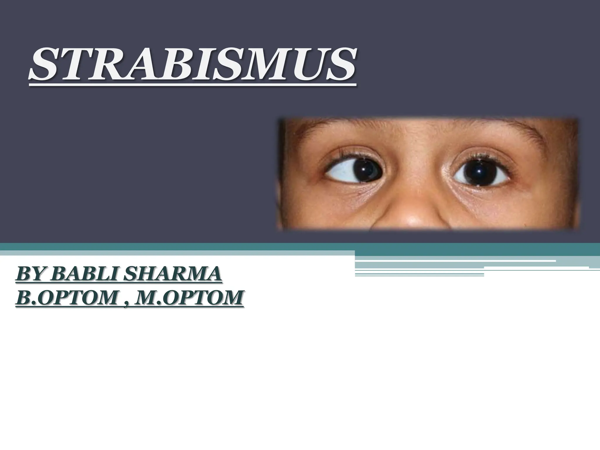 STRABISMUS EXAMINATION.pptx............. | PPTX