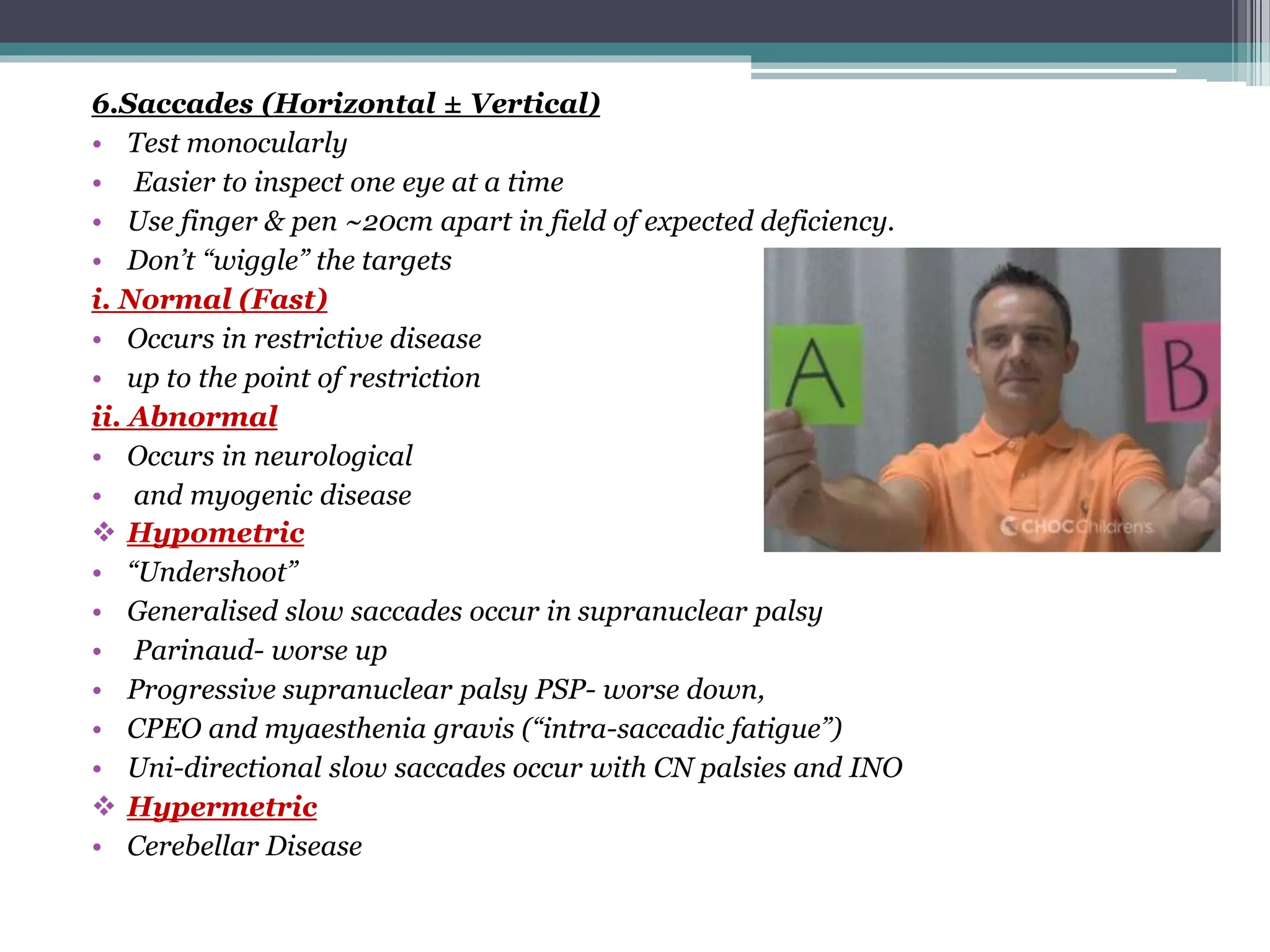 STRABISMUS EXAMINATION.pptx............. | PPTX