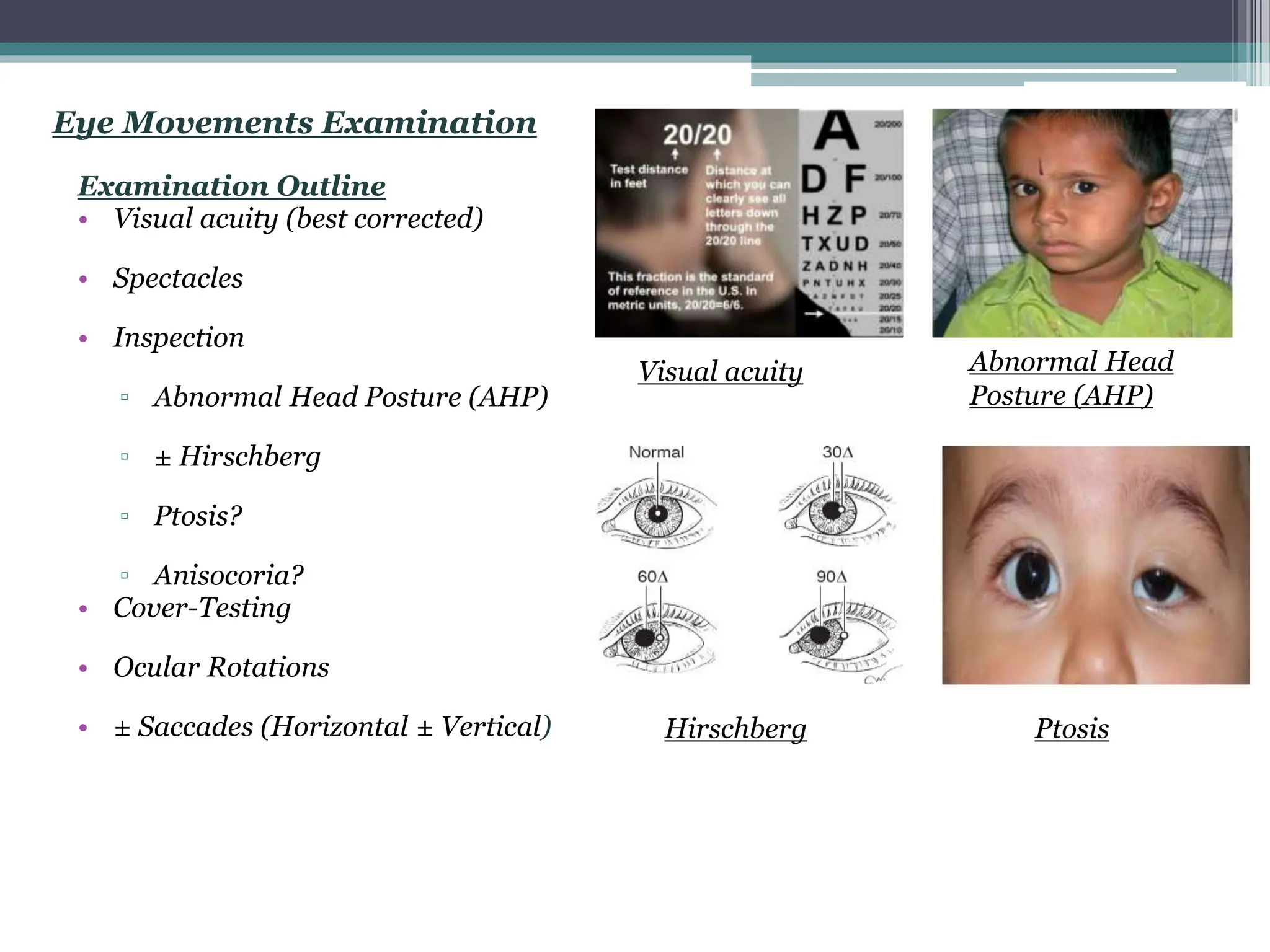 STRABISMUS EXAMINATION.pptx............. | PPTX