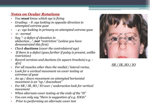 STRABISMUS EXAMINATION.pptx............. | PPTX