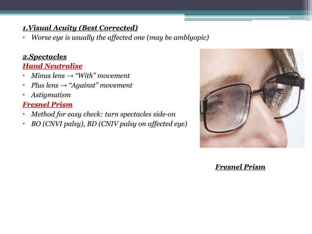 STRABISMUS EXAMINATION.pptx............. | PPTX