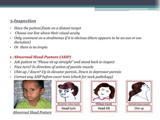 STRABISMUS EXAMINATION.pptx............. | PPTX