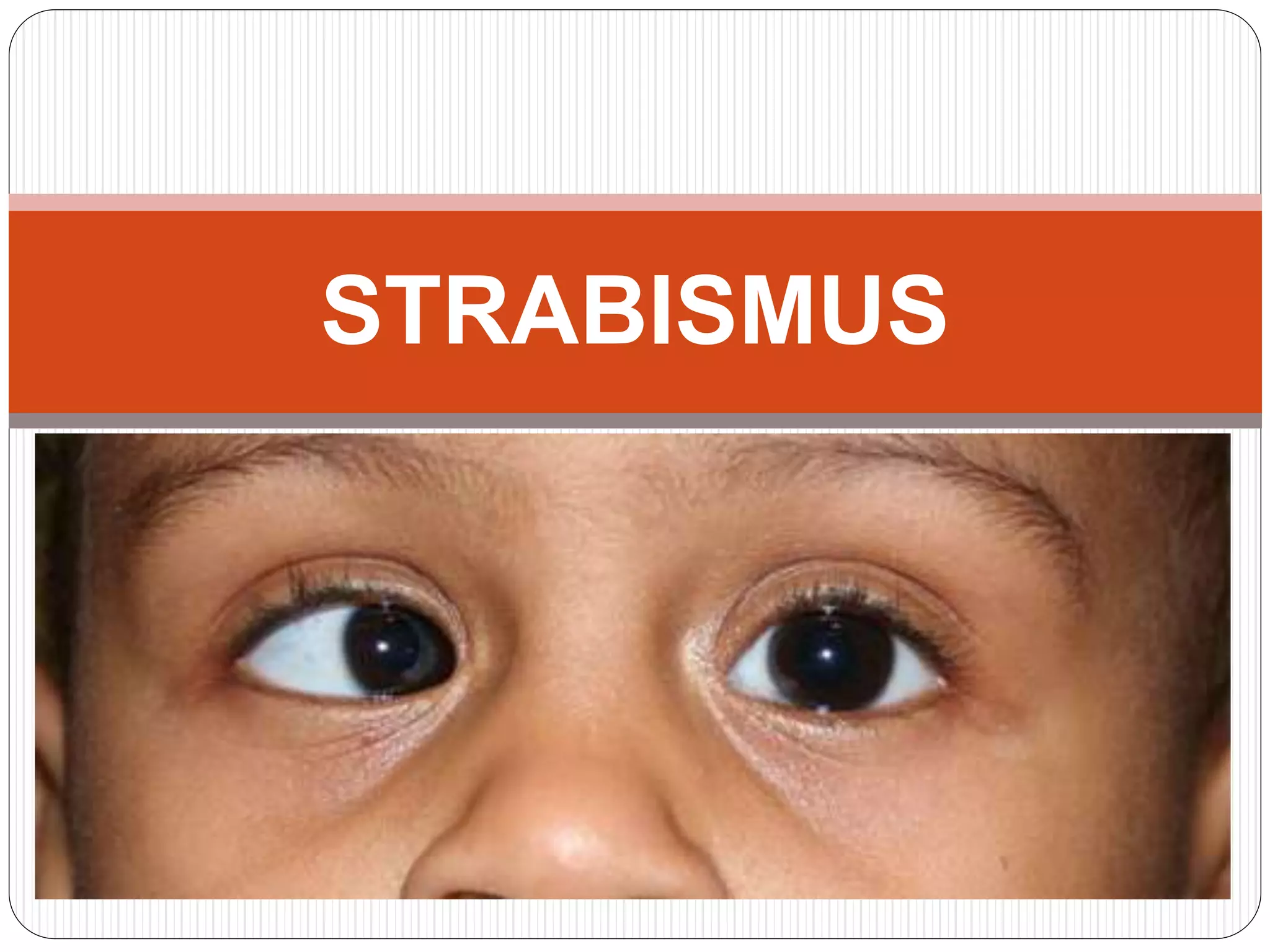 Strabismus - Dr. Halal | PPTX | Eye and Vision Conditions | Diseases and Conditions