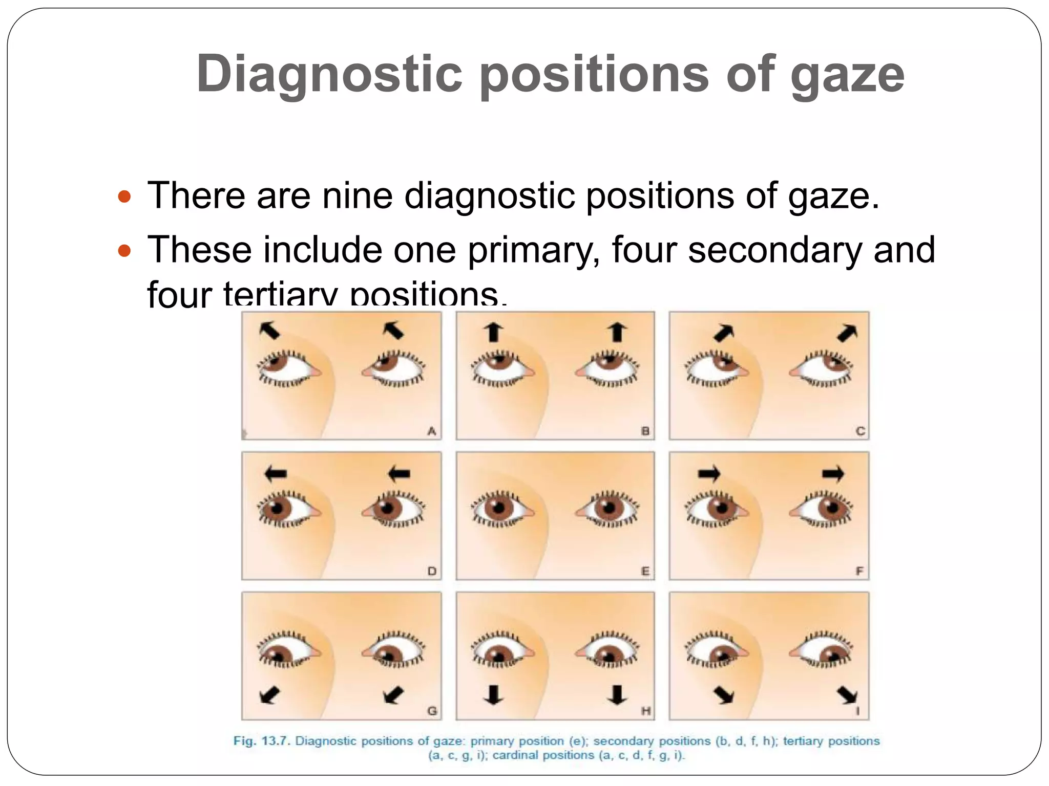 Strabismus - Dr. Halal | PPTX | Eye and Vision Conditions | Diseases ...