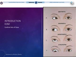 Strabismus squint evaluation and management | PPT