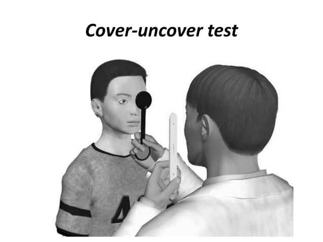 Strabismus and squint | PPT