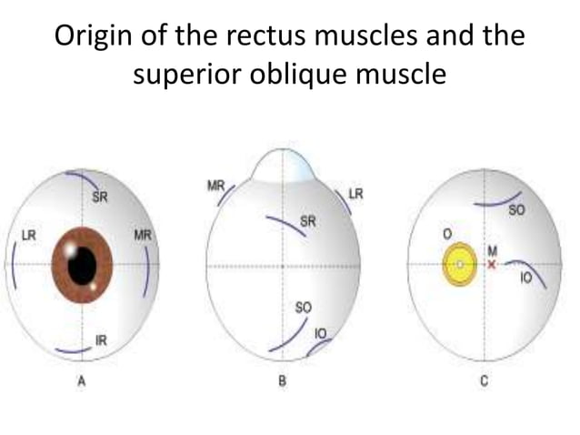 Strabismus and squint | PPT