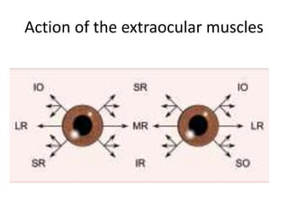 Strabismus and squint | PPT
