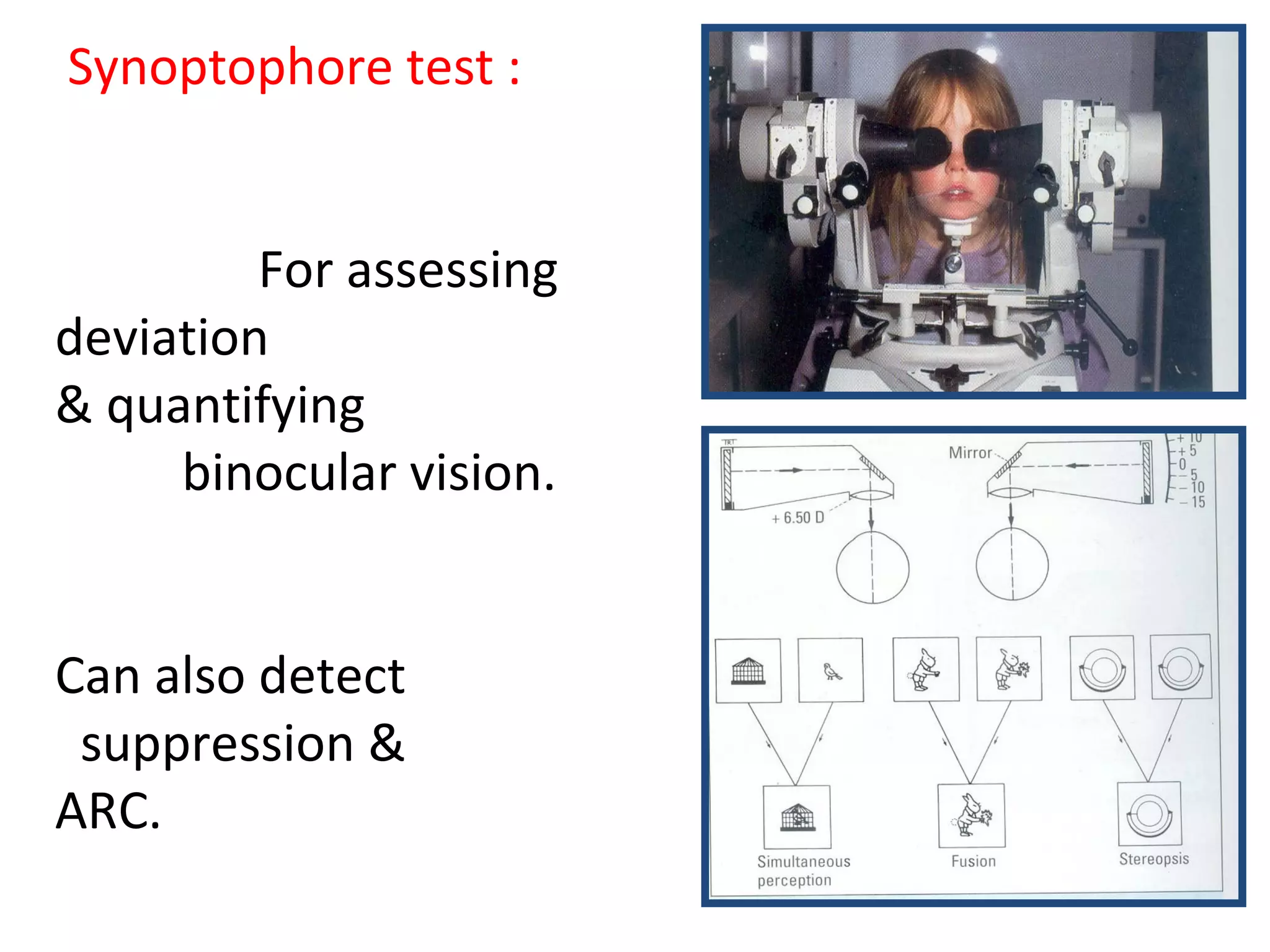 Strabismus by raju | PPT | Eye and Vision Conditions | Diseases and ...