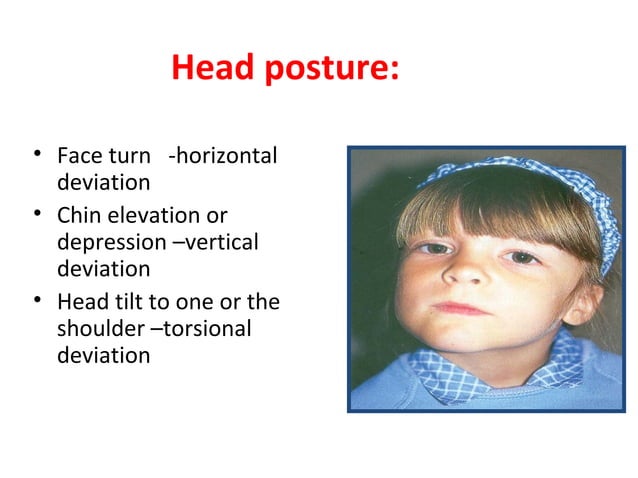 Strabismus by raju | PPT | Eye and Vision Conditions | Diseases and ...