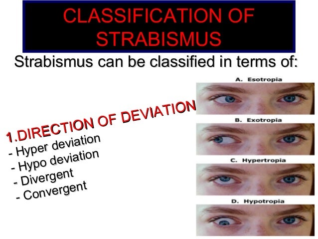 Strabismus by raju