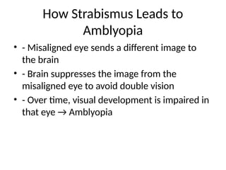 Strabismus_Causing_Amblyopia_Presentation.pptx