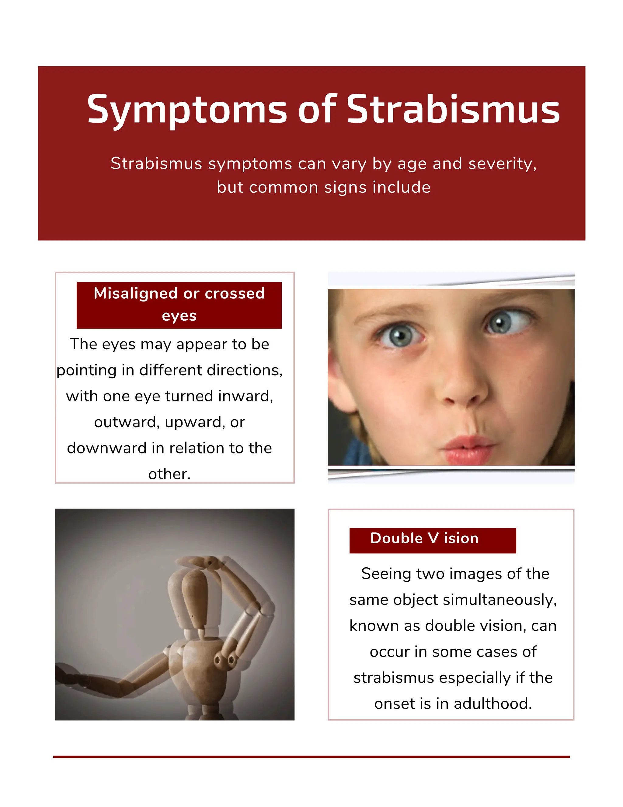 Strabismus in Children and Adults - Nexus Eye Care | PDF