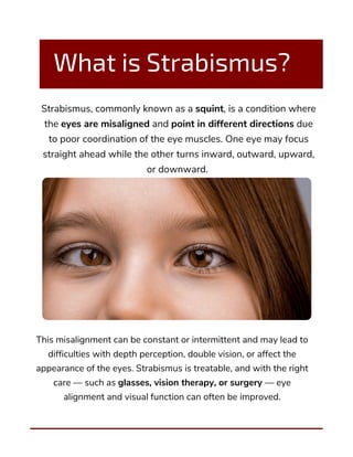Strabismus in Children and Adults - Nexus Eye Care | PDF
