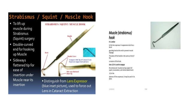 Strabismus o.a class | PPT