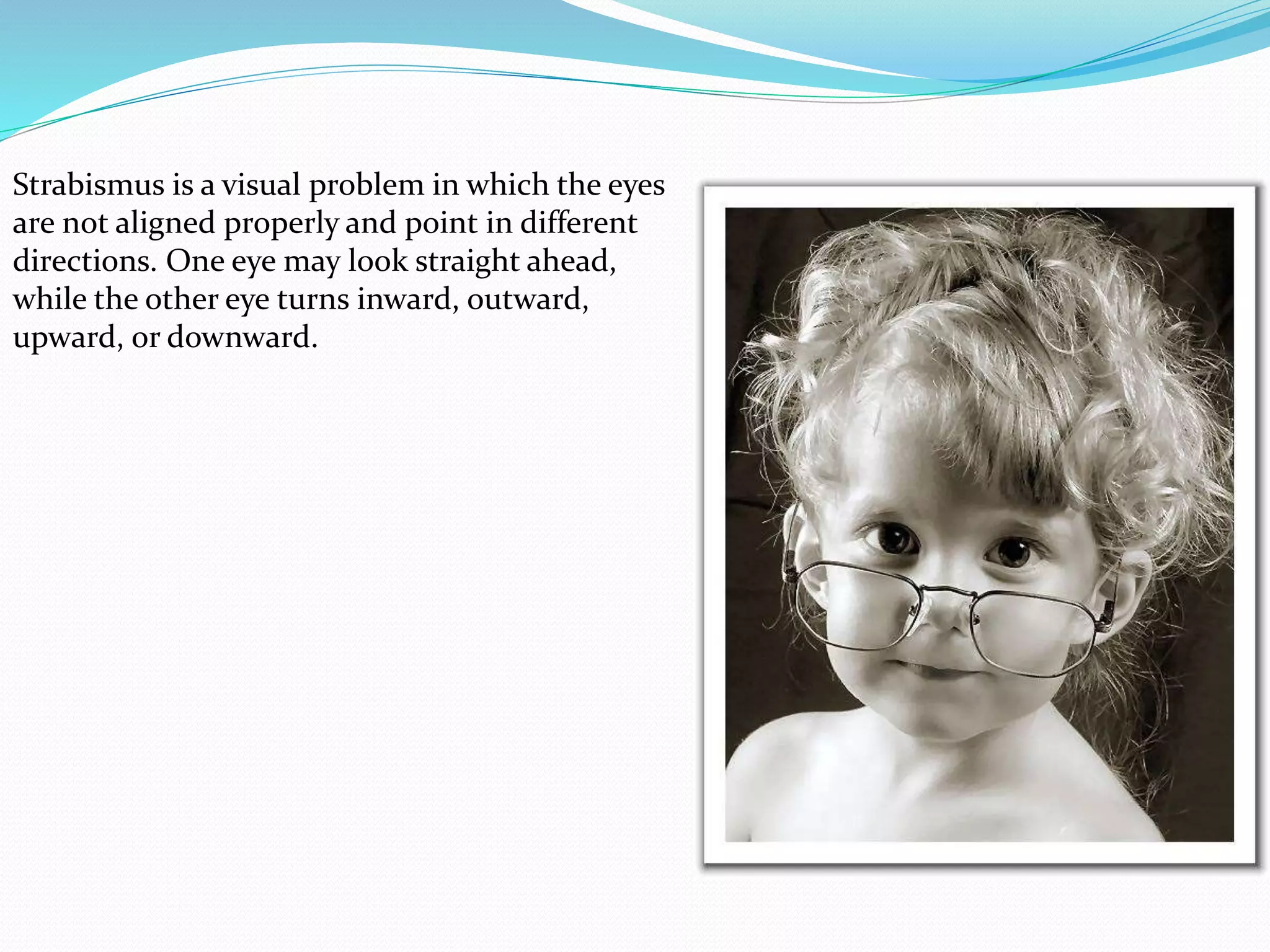 Strabismus patients evaluation | PPTX
