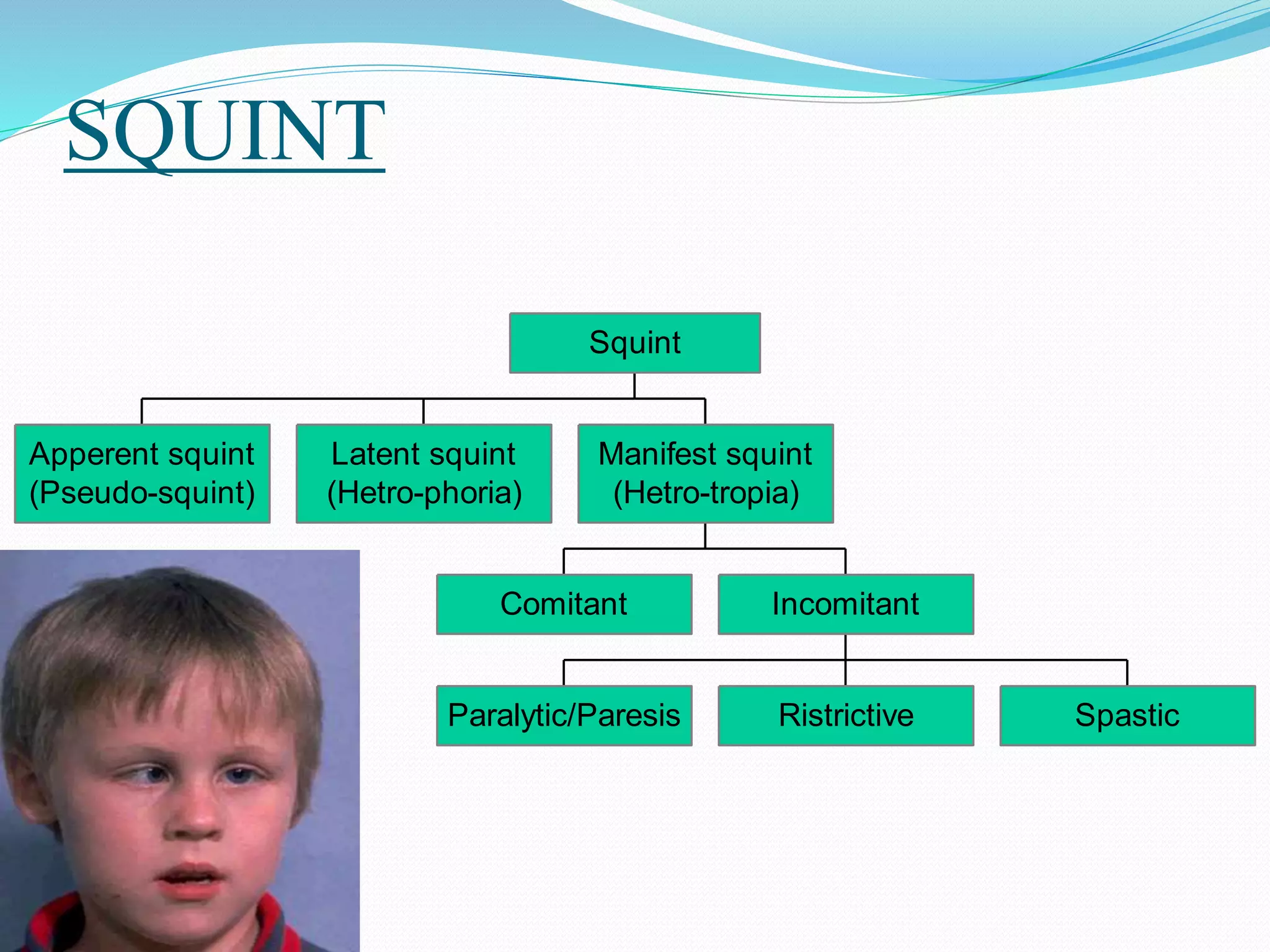 Strabismus patients evaluation | PPTX