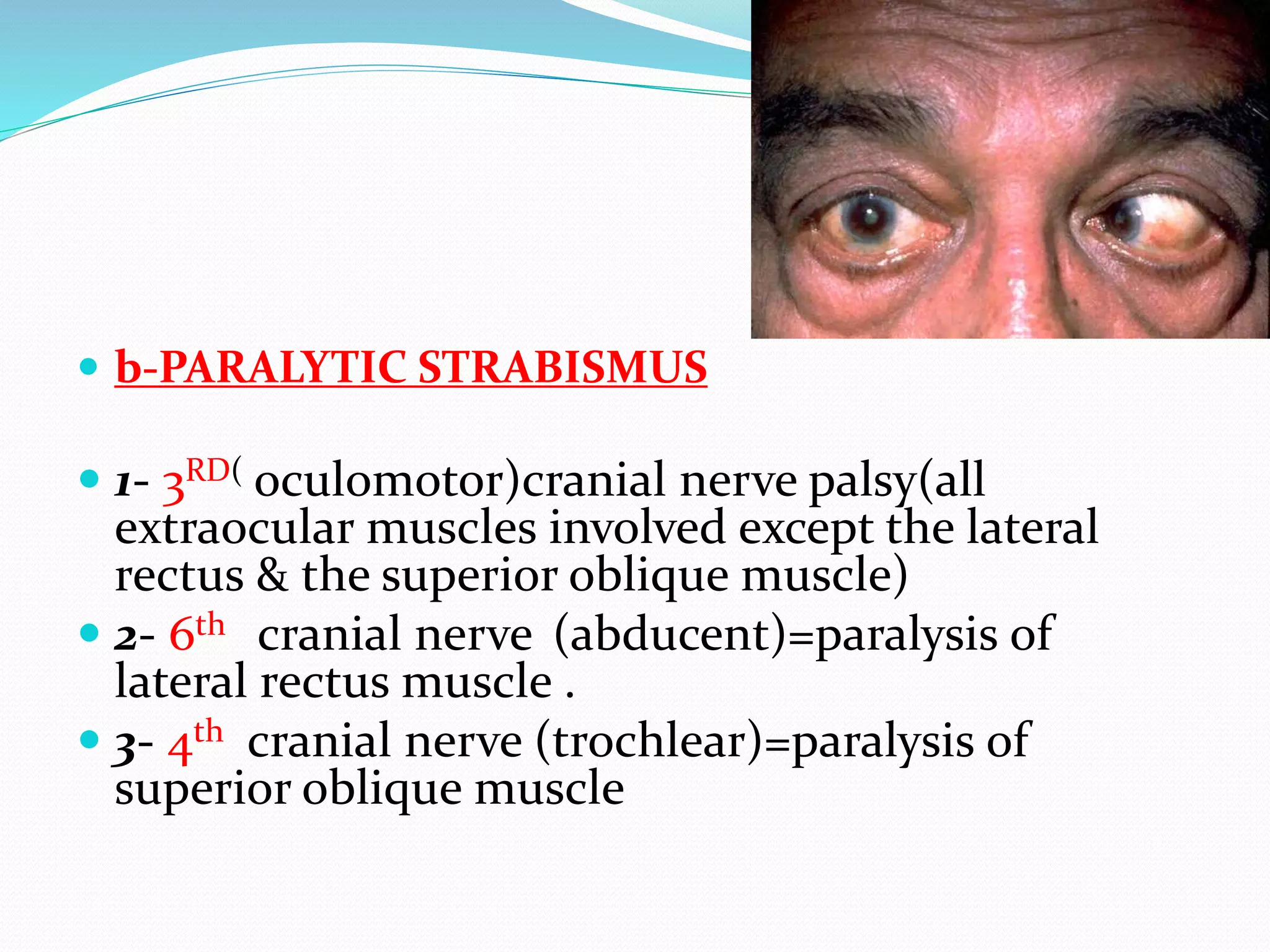 Strabismus patients evaluation | PPTX