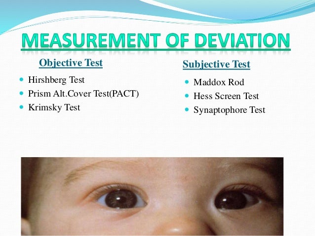 Strabismus patients evaluation