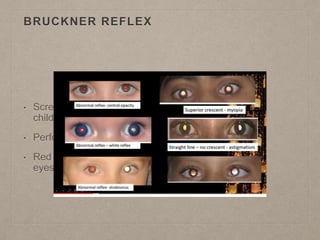 approach to a strabismus patient | PPTX