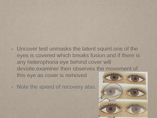 approach to a strabismus patient | PPTX