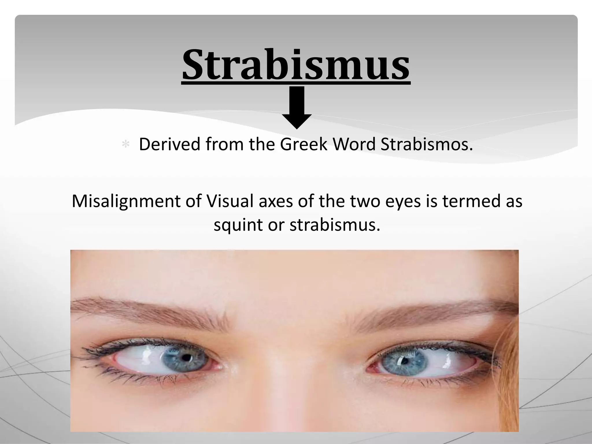 STRABISMUS(Squint) only classification | PPTX