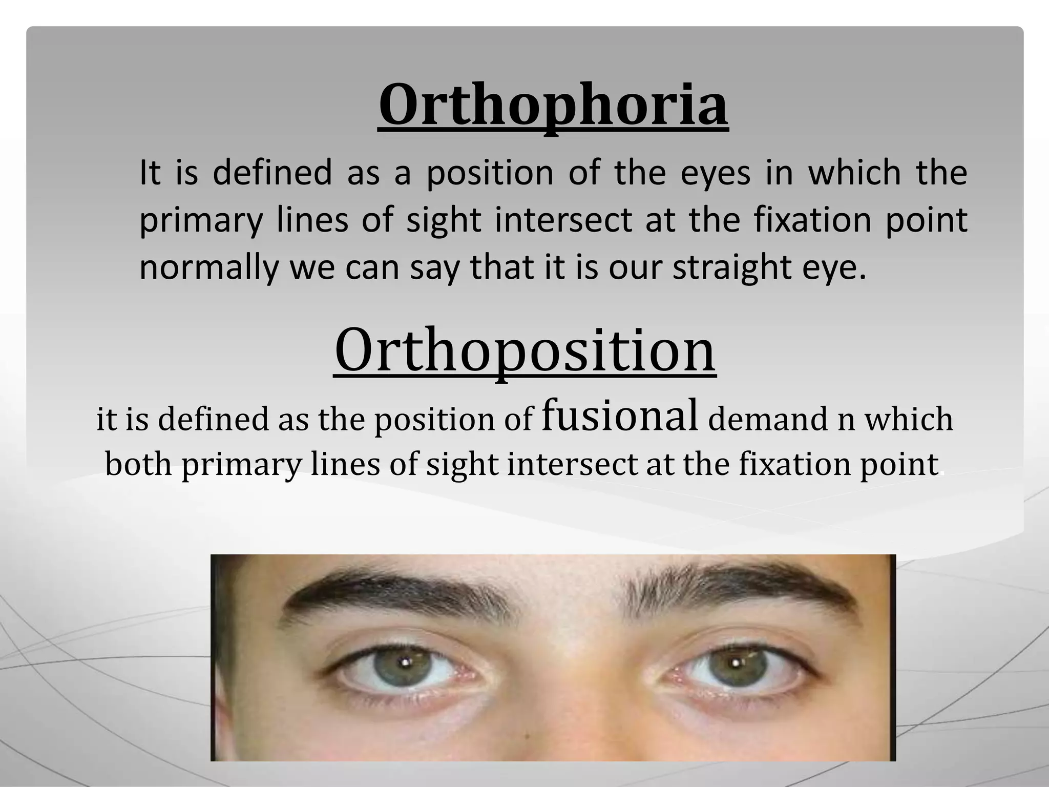 STRABISMUS(Squint) only classification | PPTX