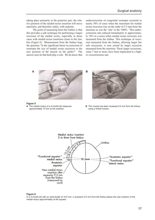 Strabismus Surgical Management of strabismus EHelveston.pdf