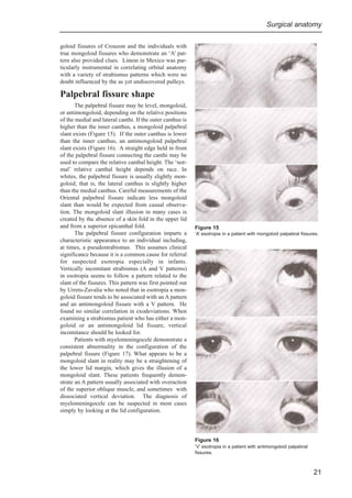 Strabismus Surgical Management of strabismus EHelveston.pdf